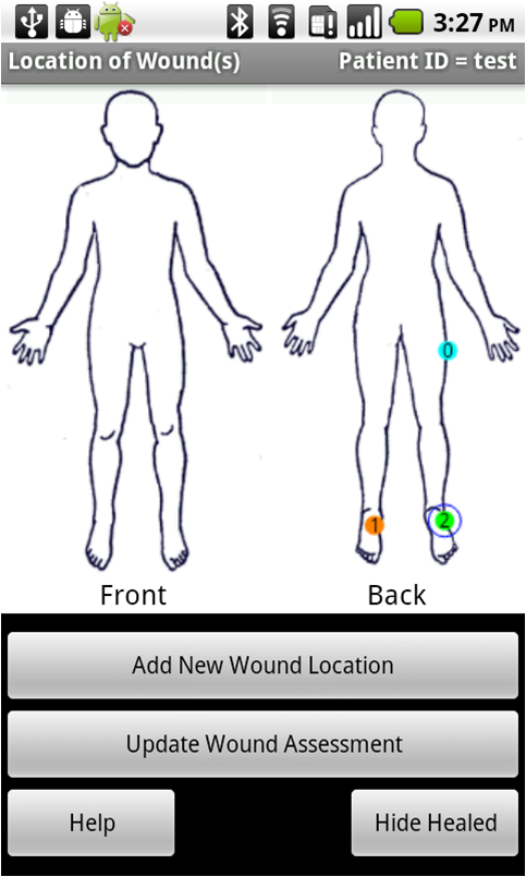 Mobile App for Wound Care